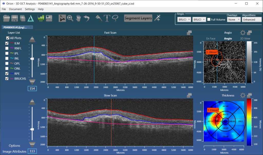Orion: Advanced OCT Analysis Software - Voxeleron