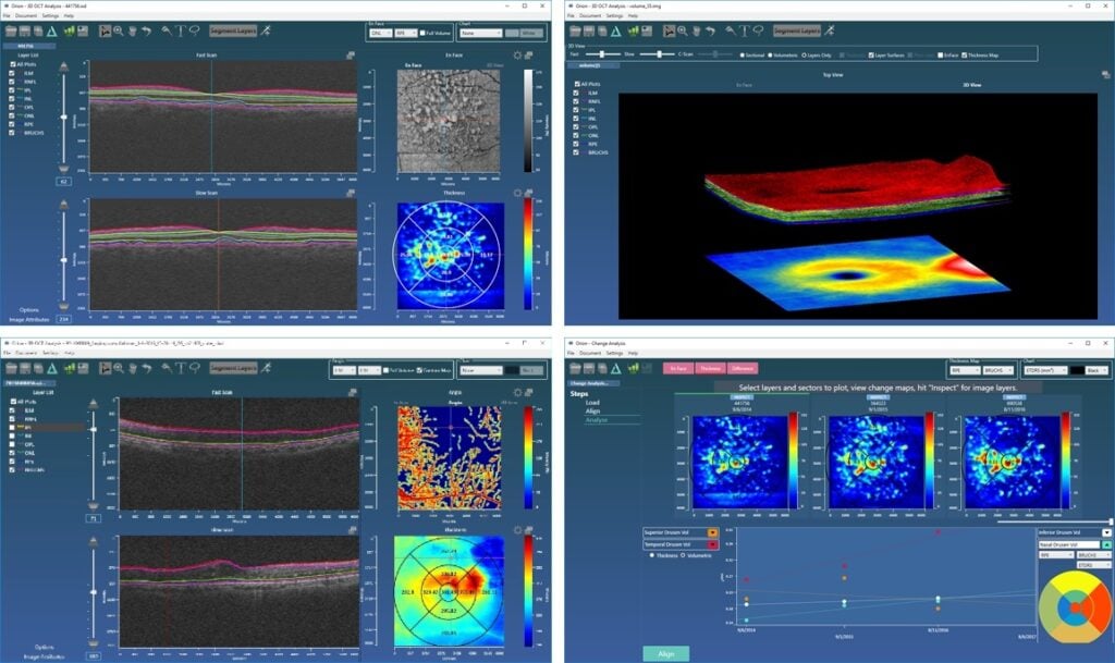 Orion: Advanced OCT Analysis Software | Voxeleron