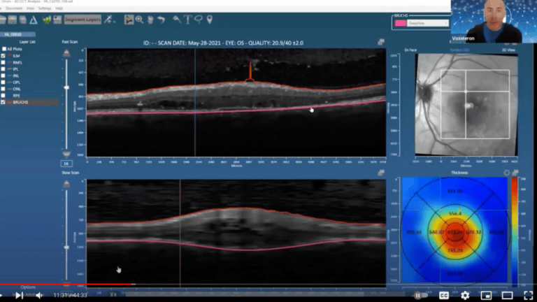 How Interoperability Drives Ophthalmic Clinical Trial Success For ...
